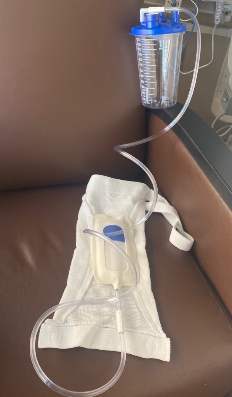 Medical Lines and Leads – UNMC OTD ACTS Manual