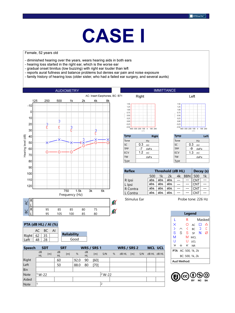 Case I – Interactive Online Case Study Workbook for Audiology Graduate Students
